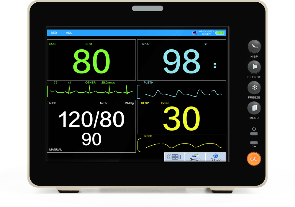 8-Inch Touchscreen+EtCO2 Portable Patient Monitor- Tracks Vital Parameters Including ECG, RESP ...